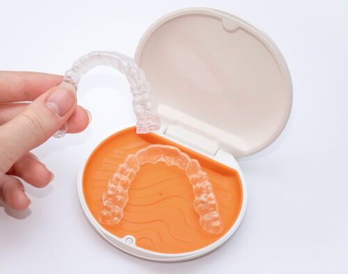 Custom Night Guards & Retainers | TMJ & Bruxism Relief Boulder